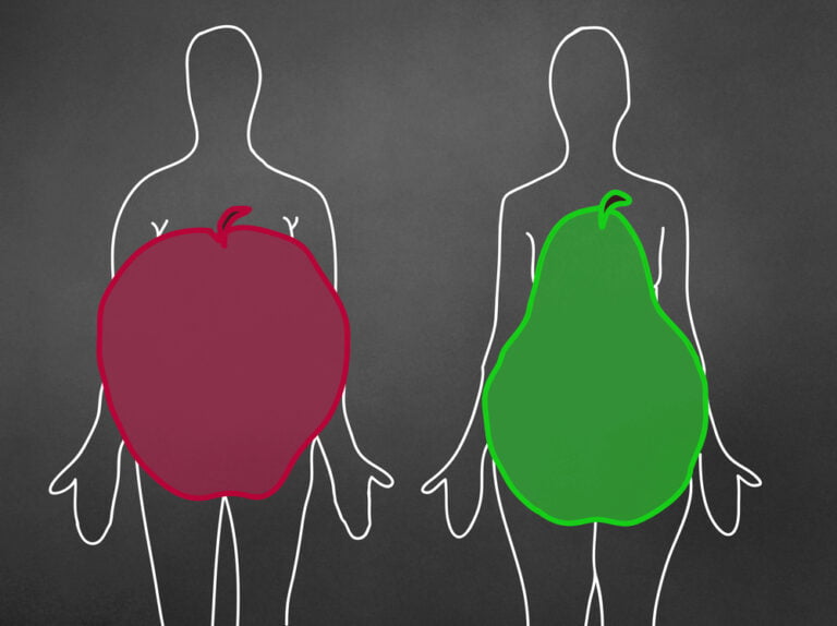 Android Obesity: Causes, Treatment and Prevention - Health